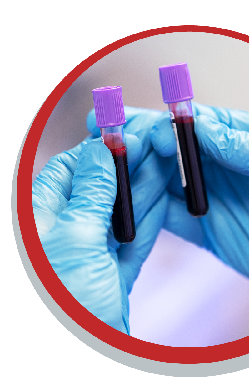 Prostate screening: What It Is, How It Works & Why It's a Crucial Step ...